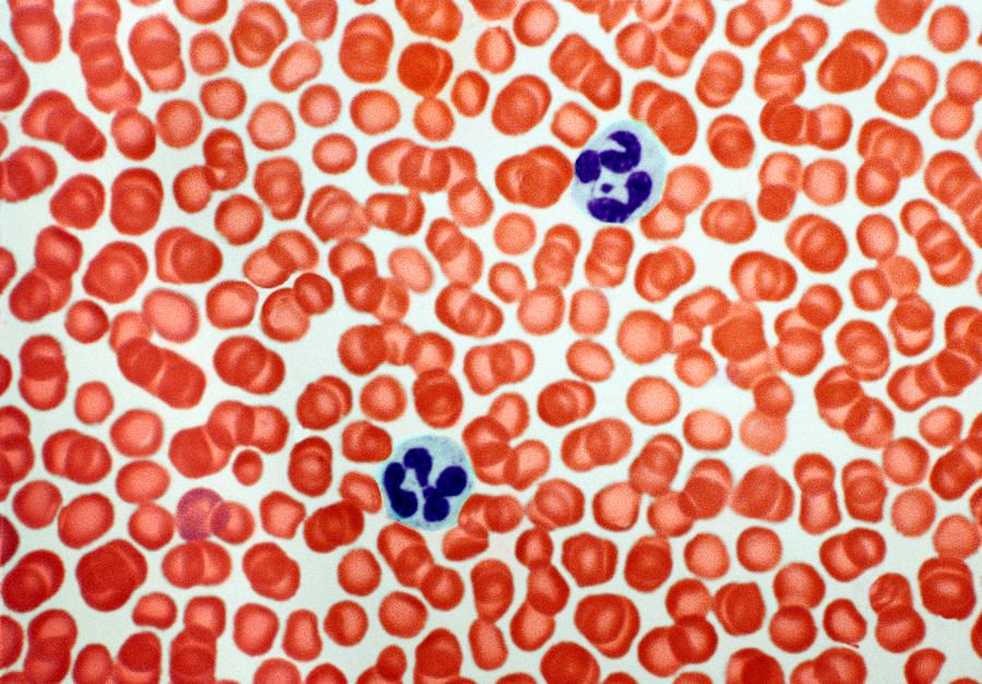 Human Blood Cells, Light Micrograph by Steve Gschmeissner Human Blood Cells, Light Micrograph by Steve Gschmeissner