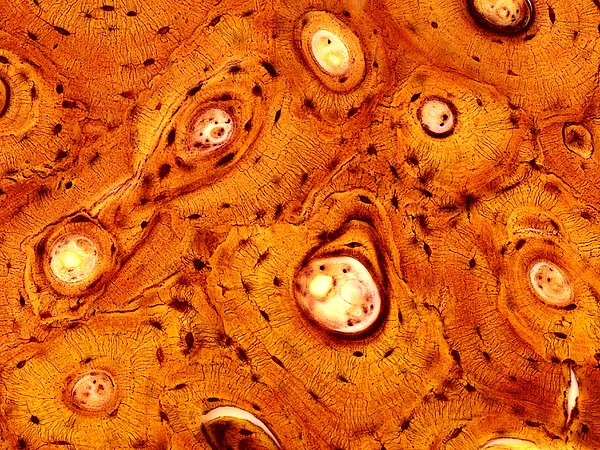Compact bone, light micrograph Greeting Card by Tissuepix / Science ...