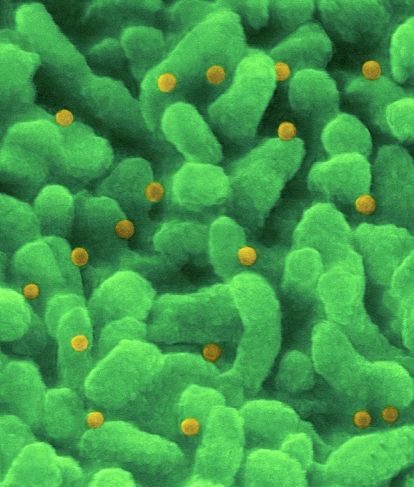 Rhinovirus Infection Of Nasal Epithelial Cell Greeting Card by Science Photo Library