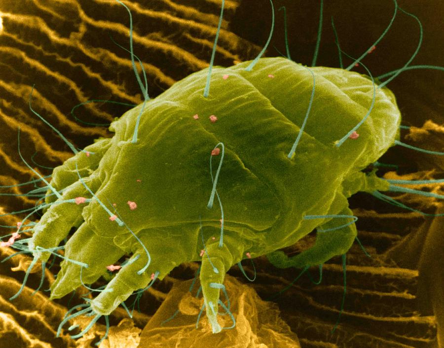 Acarine Mite, Sem Photograph by Science Source - Fine Art America