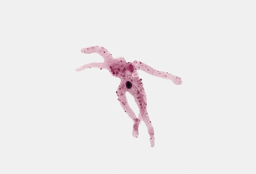 Amoeba Proteus, Protozoan, Lm Photograph by Science Stock Photography - Pixels