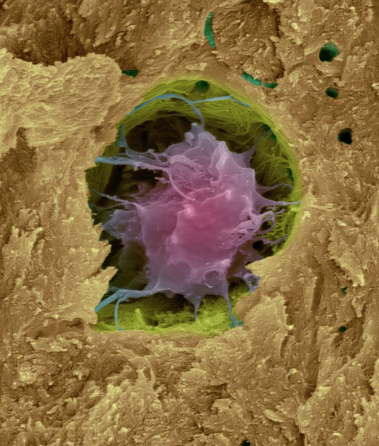 Bone Cell In Compact Bone Photograph by Dennis Kunkel Microscopy ...