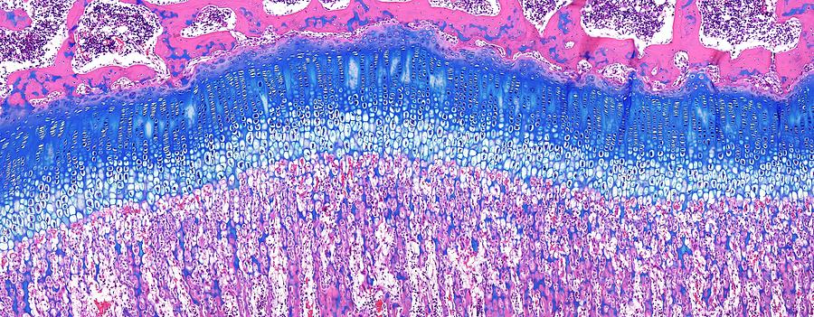 Bone Growth Plate #1 Photograph by Microscape / Science Photo Library ...