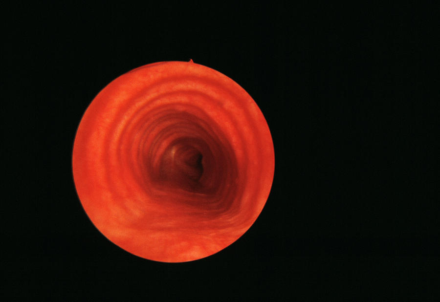 Bronchus Photograph by Cnri/science Photo Library - Fine Art America