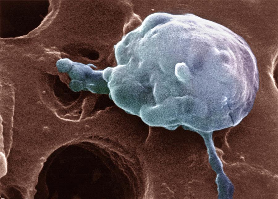 Cancer Cell Attacked By Macrophages Photograph by Ami Images/science ... Cancer Cell Attacked By Macrophages Photograph by Ami Images/science ...
