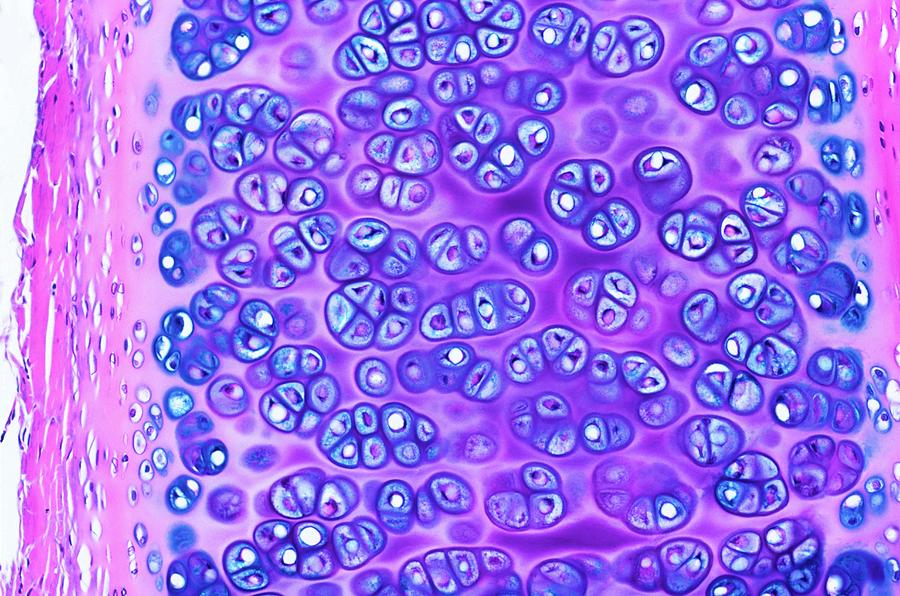 Cartilage #1 by Science Photo Library