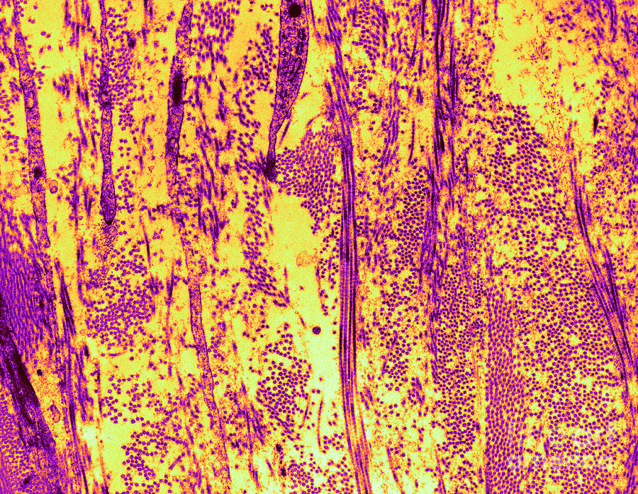 Collagen, Tem Photograph by David M. Phillips - Fine Art America