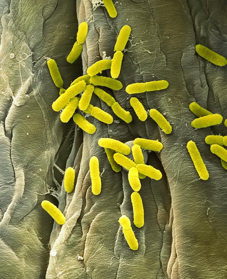E Coli Bacteria Sem Photograph By Science Photo Library