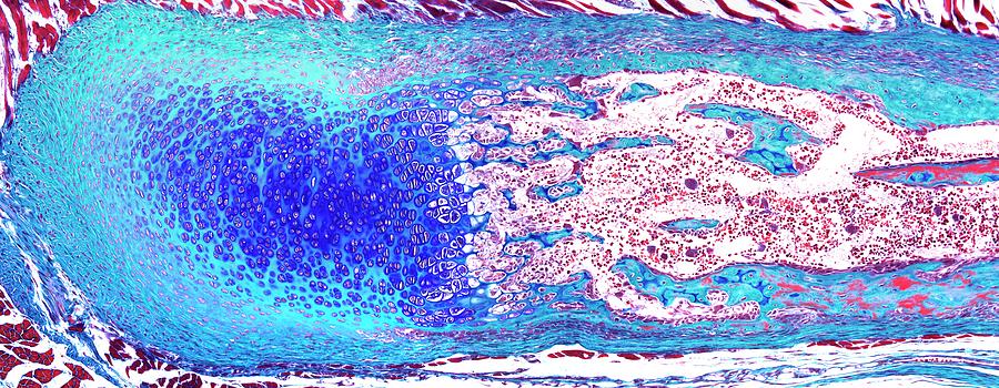 Growing Bone #1 by Science Photo Library