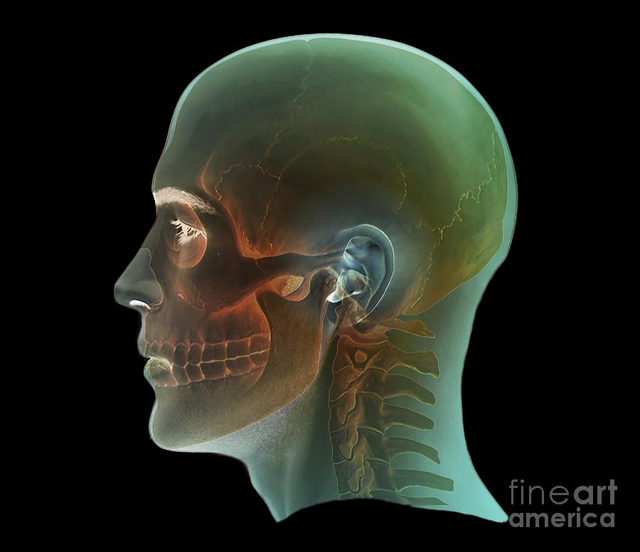 Human Head, 3d Ct Scan Photograph by Zephyr - Pixels