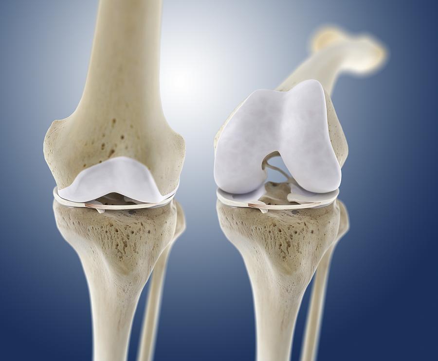 Knee flexion anatomy, artwork Photograph by Science Photo Library - Pixels