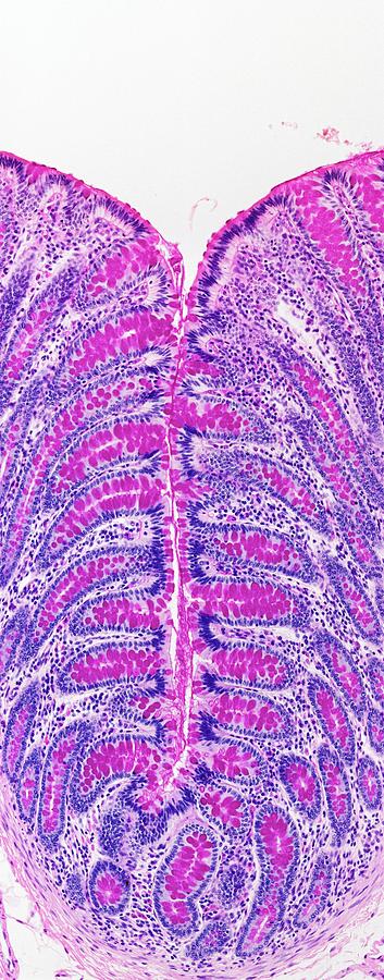 Large Bowel #1 by Science Photo Library