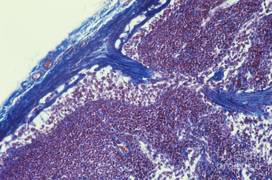 Lymph Node, Light Micrograph #1 by Science Photo Library