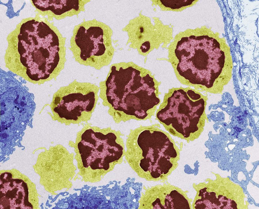 Lymph Node #1 by Science Photo Library