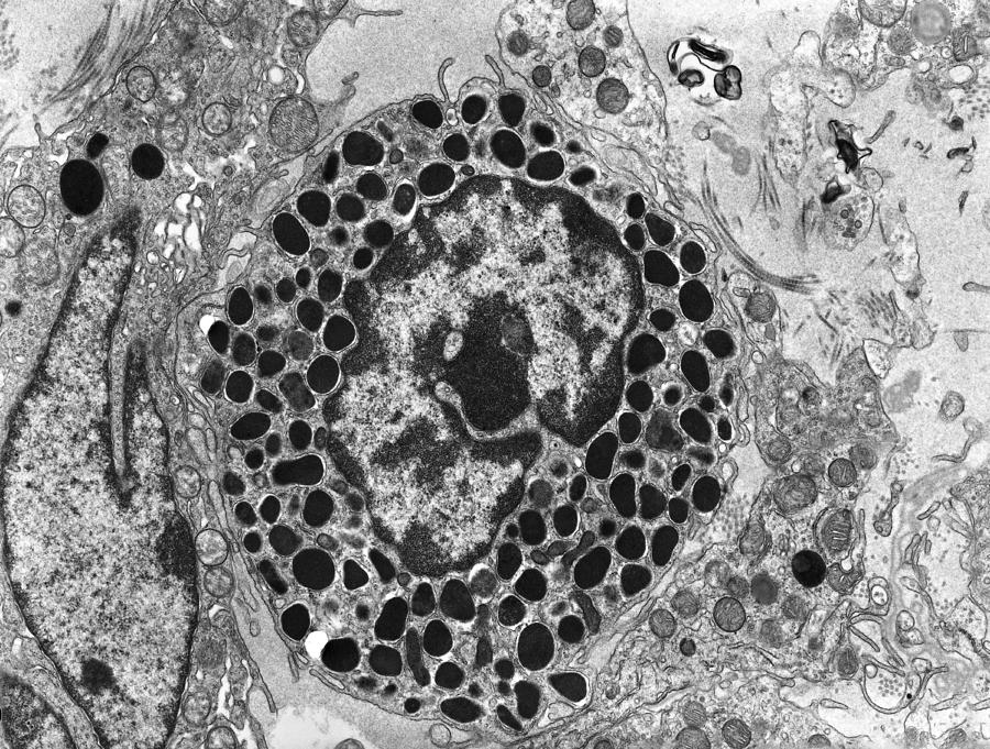 Mast cell, TEM Photograph by Science Photo Library - Pixels