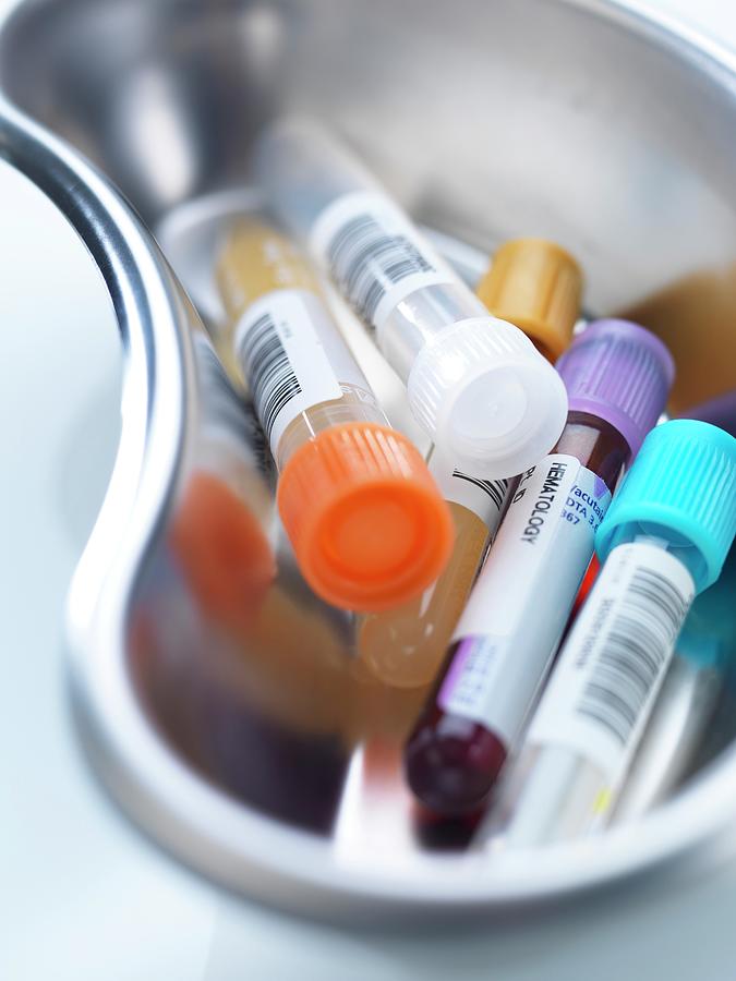 Medical Samples #1 Photograph by Science Photo Library - Pixels Merch