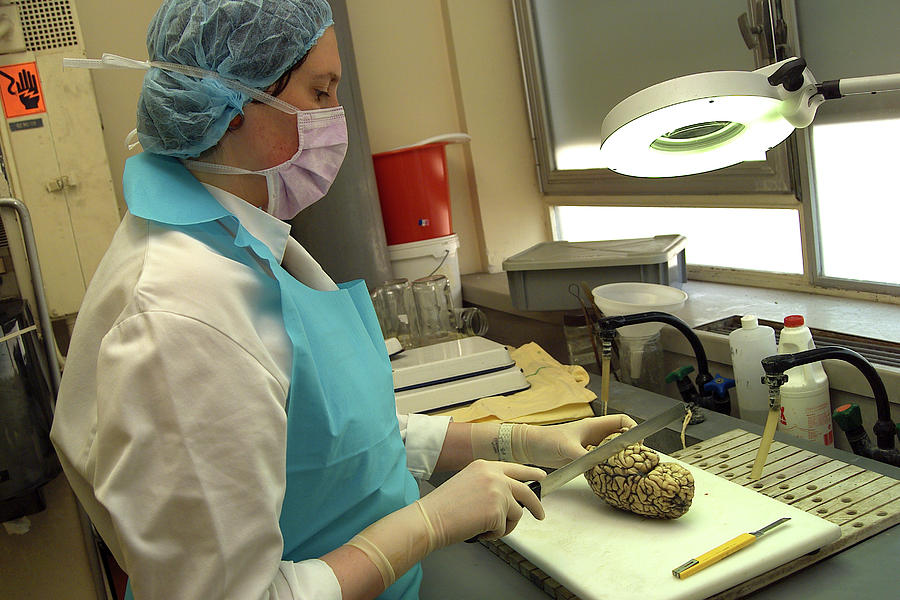 Multiple Sclerosis Brain Dissection #1 by Science Photo Library