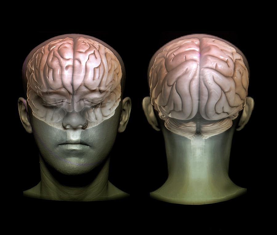 Normal Brain Photograph by Zephyr - Fine Art America