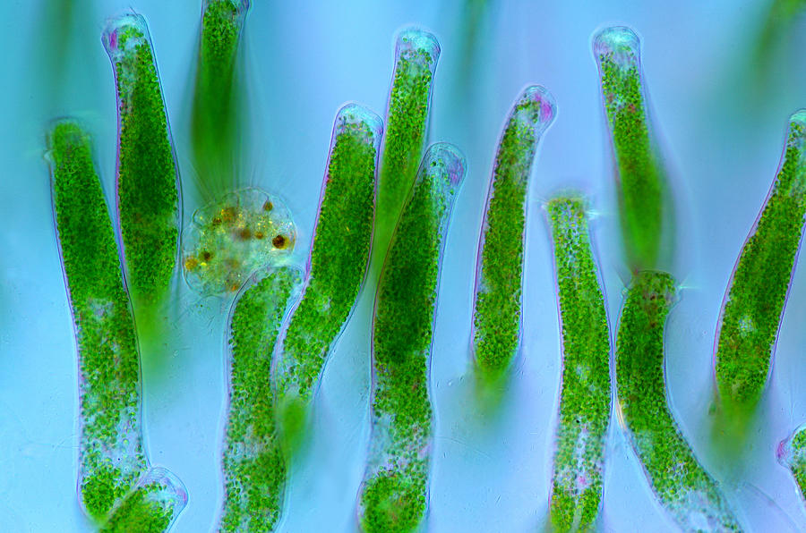 Ophrydium And Heliozoan, Lm Photograph by Marek Mis - Pixels