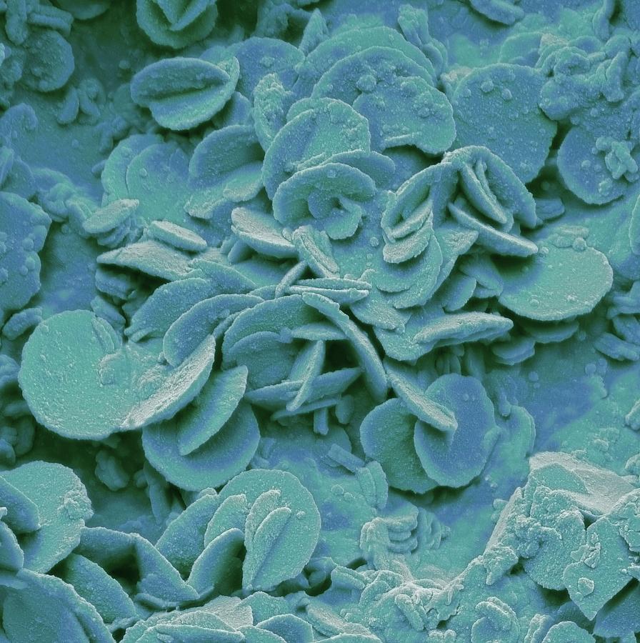 Rust Photograph by Steve Gschmeissner/science Photo Library - Fine Art ...