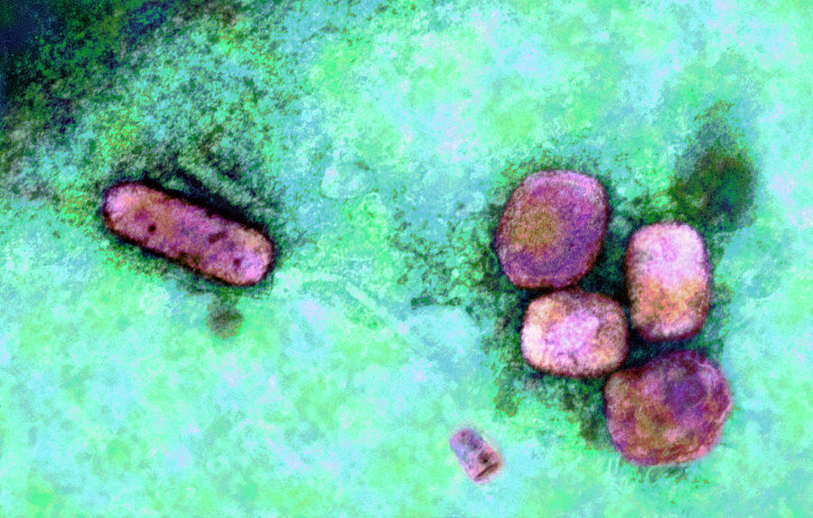Smallpox Virus Particles Photograph by Cdc/science Photo Library - Fine Art America