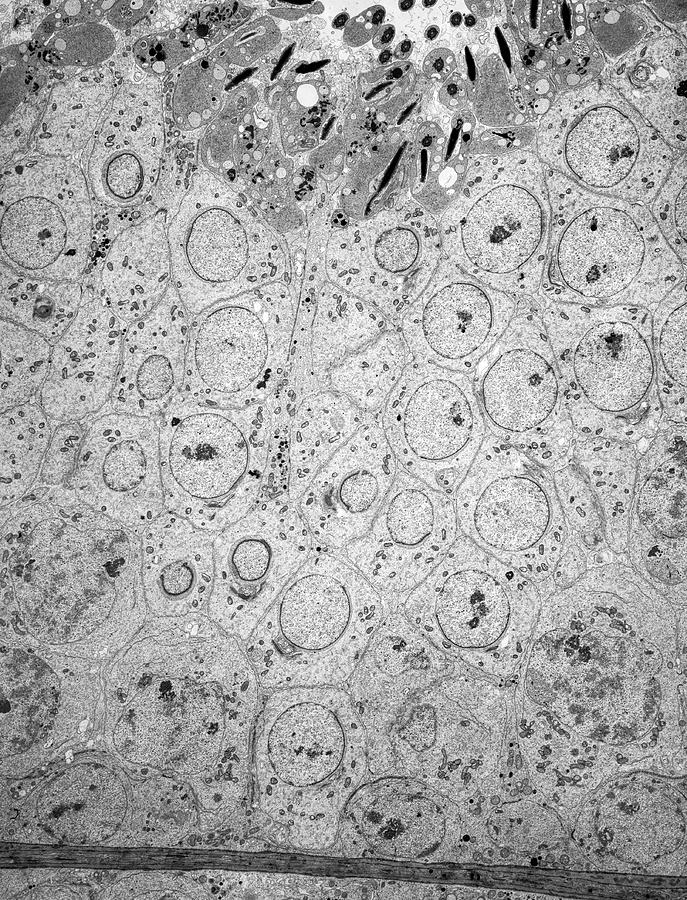 Sperm Maturing In Testis #1 by Science Photo Library