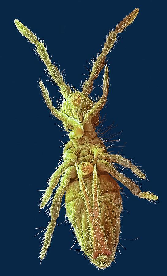 Springtail Photograph by Steve Gschmeissner/science Photo Library ...