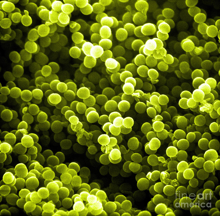 Staphylococcus Aureus, Sem Photograph by David M. Phillips - Pixels