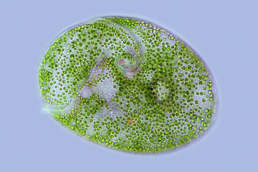 Stentor Sp. Protozoan #1 Photograph by Marek Mis - Pixels Stentor Sp. Protozoan #1 Photograph by Marek Mis - Pixels