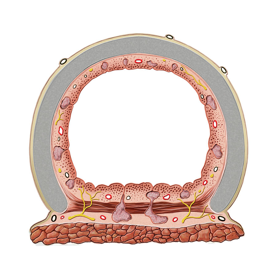 Trachea #1 Photograph by Science Photo Library - Pixels Merch