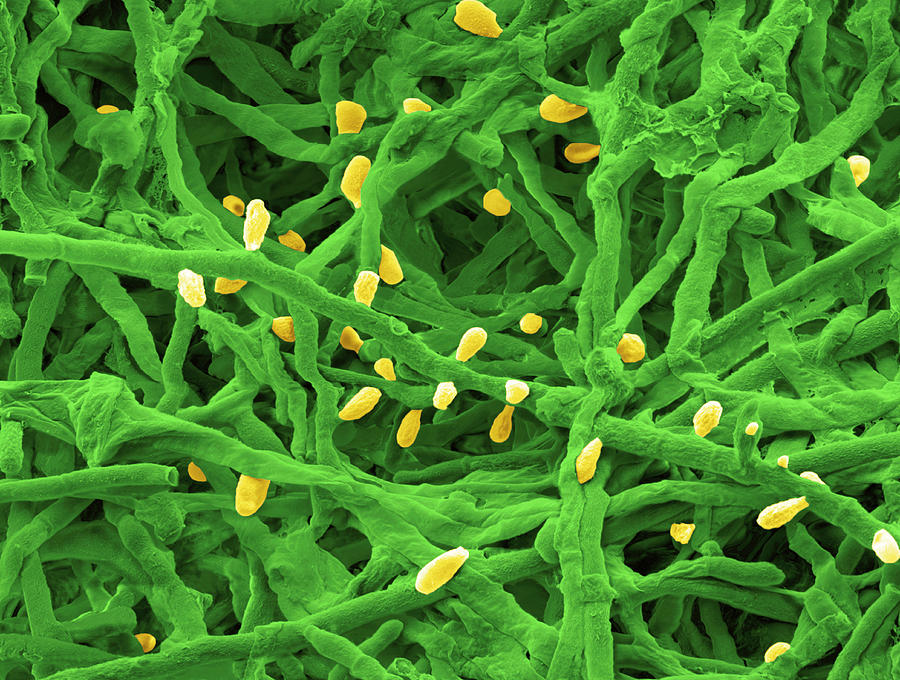 Trichophyton Fungus Photograph By Thierry Berrod Mona Lisa Production Pixels