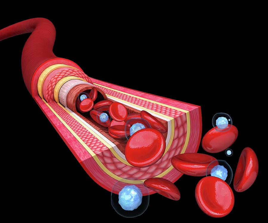 Human Artery #10 by Pixologicstudio / Science Photo Library
