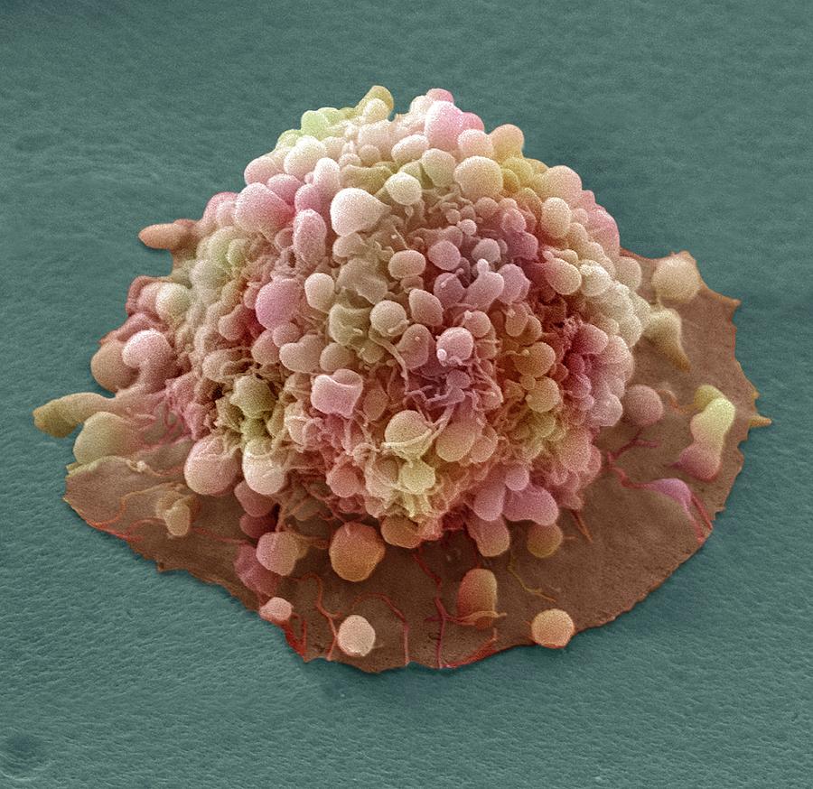 Cervical Cancer Cell Photograph By Steve Gschmeissner Pixels