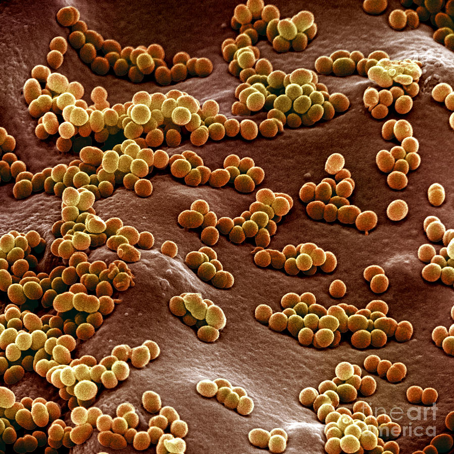 Staphylococcus Aureus Photograph by David M. Phillips - Fine Art America