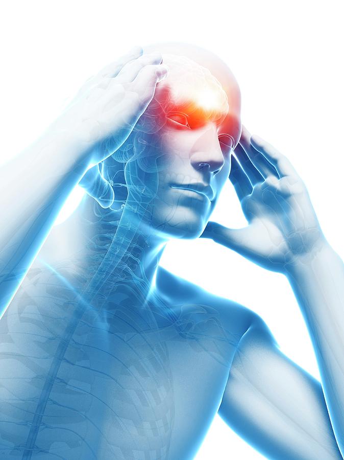Headache Photograph by Sciepro/science Photo Library - Fine Art America
