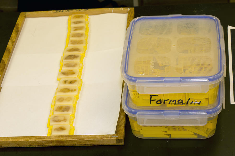 Brain Samples Embedded In Wax Photograph by Science Stock Photography