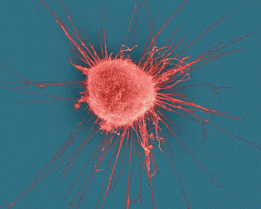 Breast Epithelial Cancer Cell Photograph by Dennis Kunkel Microscopy ...