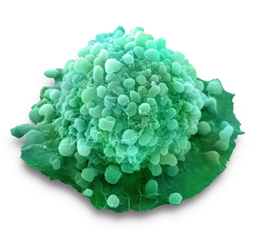 Cervical Cancer Cell 2 Photograph By Steve Gschmeissner Pixels