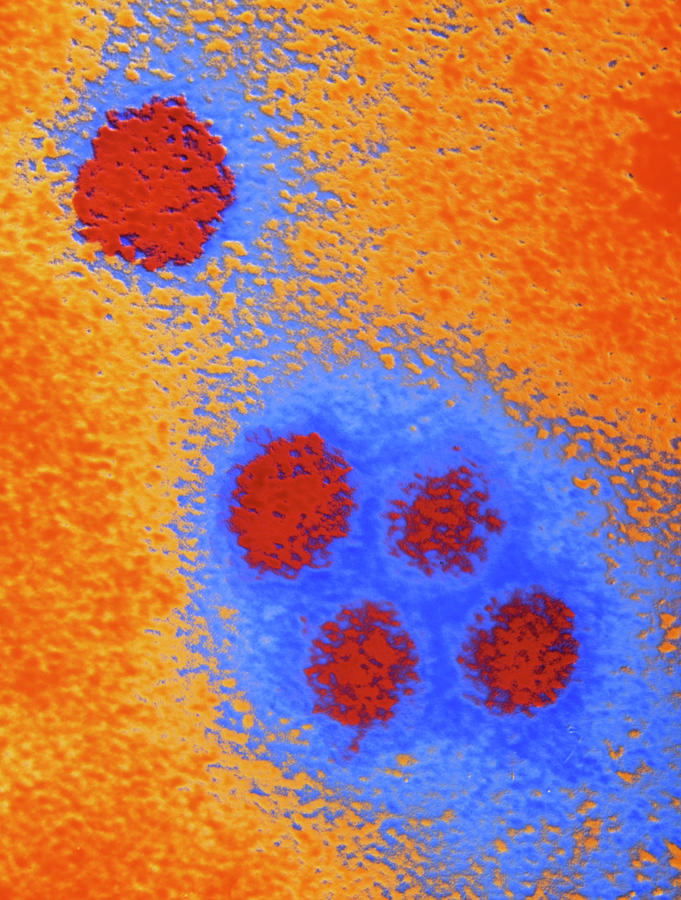 Coloured Tem Of Dengue Virus Particles Photograph by London School Of Hygiene And Tropical ...