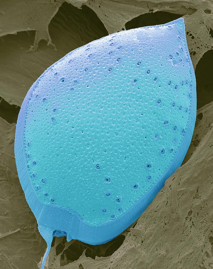 Dinoflagellate Photograph by Steve Gschmeissner/science Photo Library ...