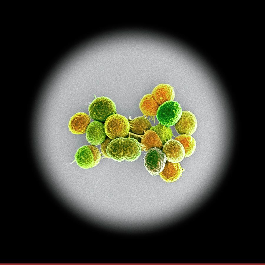 Enterococcus Faecalis Bacteria #2 Photograph by Science Photo Library ...