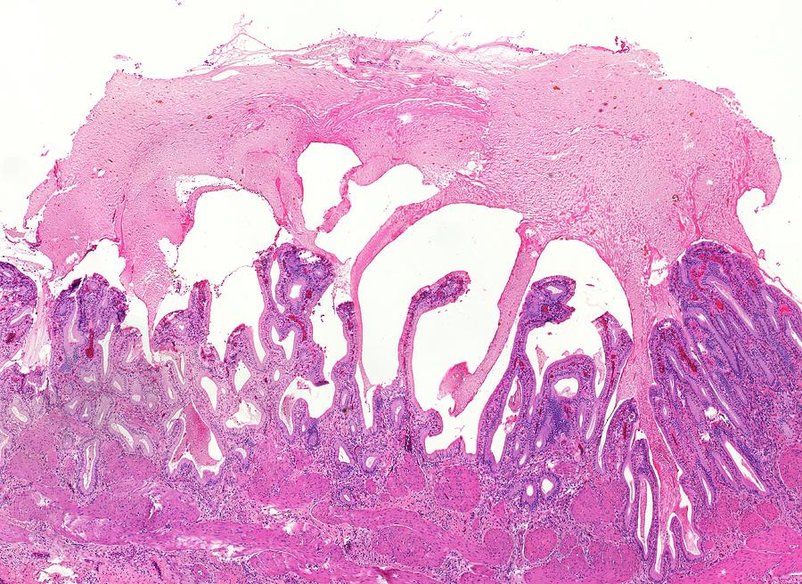 Gall Bladder #2 by Microscape / Science Photo Library