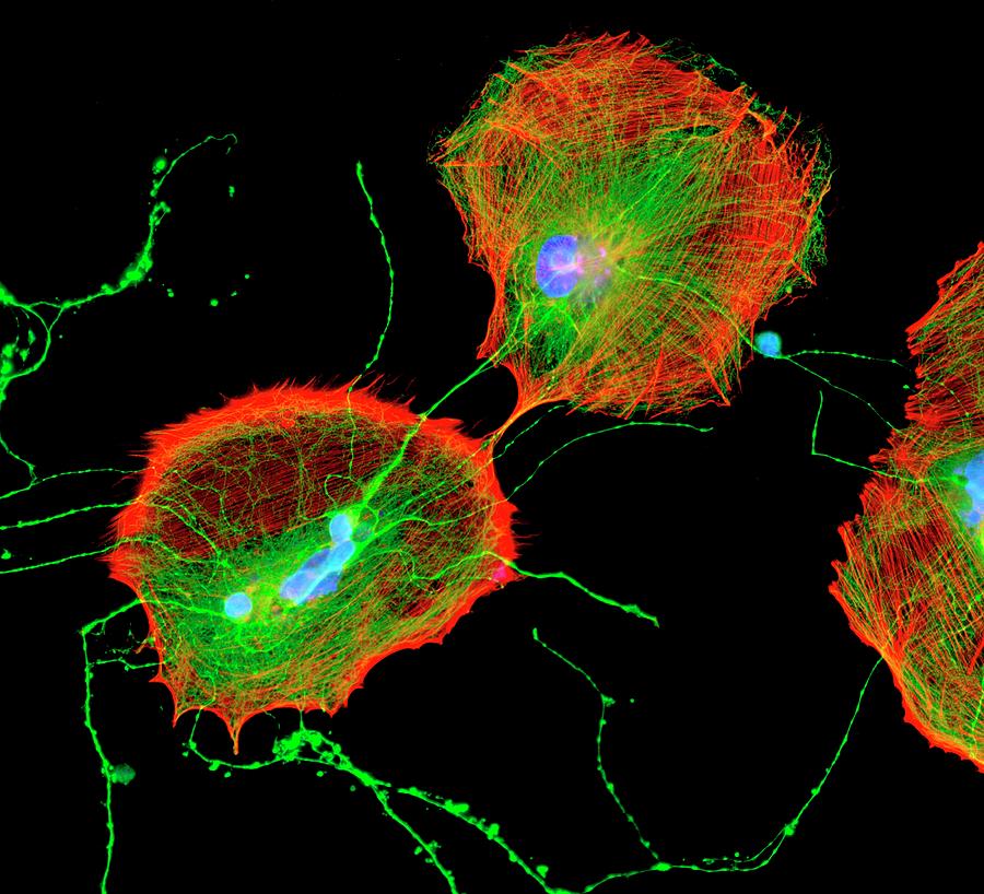 Glial Cells Photograph by Dr Jan Schmoranzer/science Photo Library - Pixels