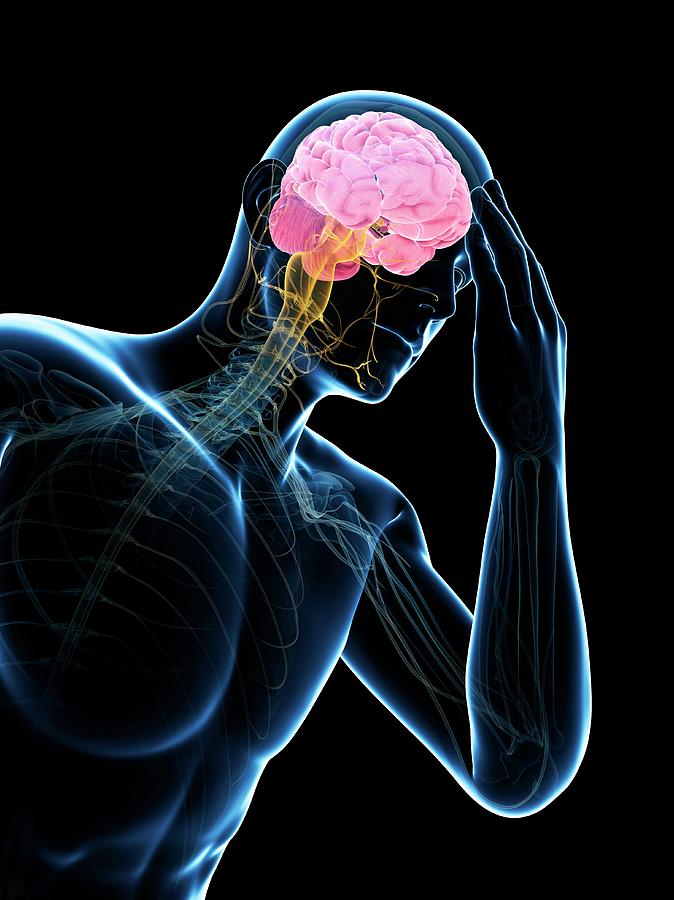 Headache #2 by Science Photo Library