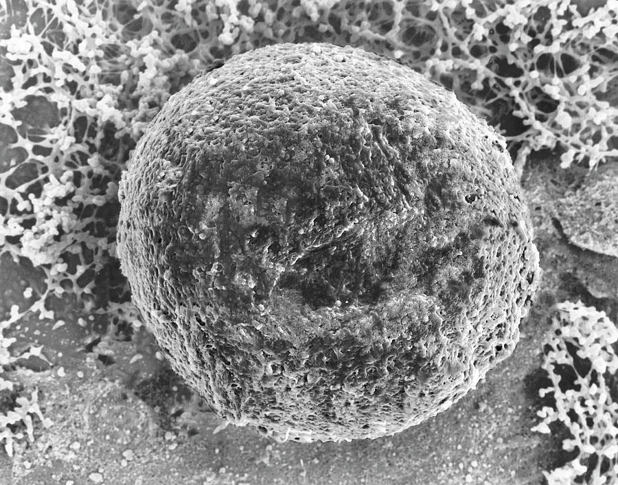 Human Egg Photograph by Dennis Kunkel Microscopy/science Photo Library ...