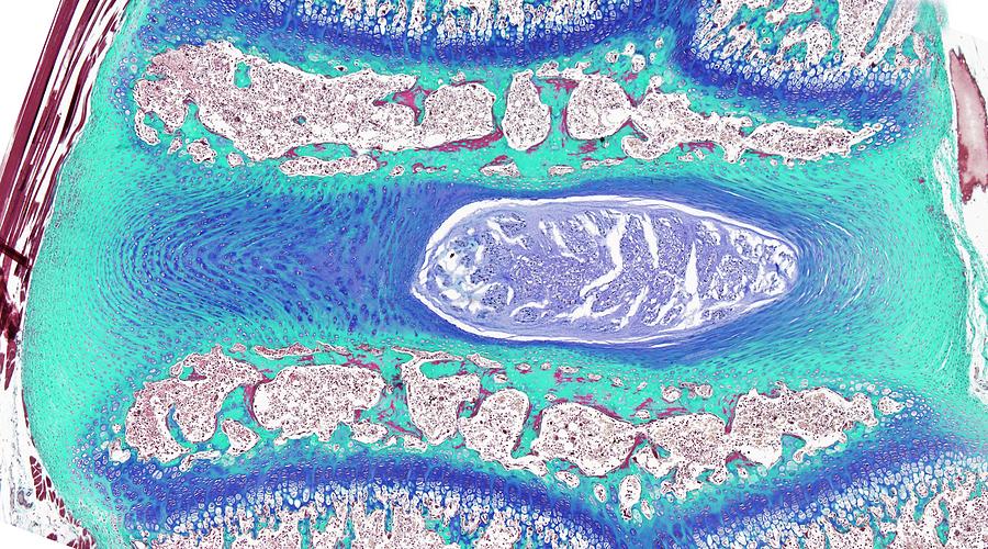 Intervertebral Disc #2 Photograph by Microscape / Science Photo Library ...