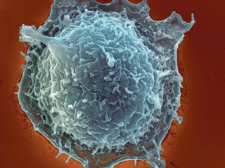 Lymphocyte #2 by Science Photo Library