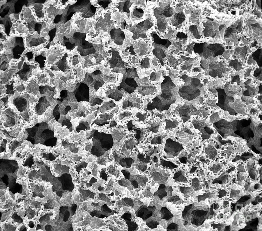 Mouse Lung, Sem Photograph by David Phillips - Fine Art America