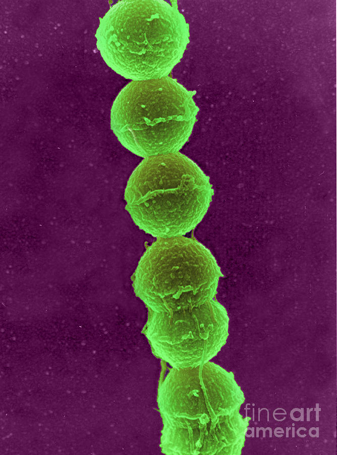 Streptococcus Bacteria, Sem #2 by Science Source
