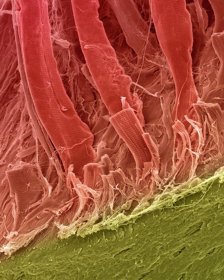 Tendons Attached To Bone Surface #2 Photograph by Science Photo Library ...